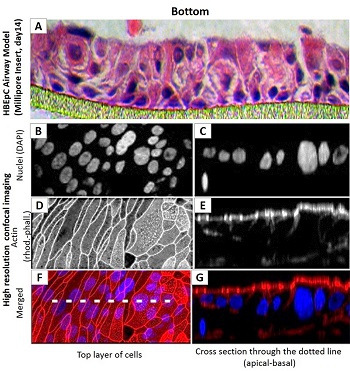Human Bronchial Epithelial Cells: HBEpC 人支氣管上皮細胞 | 慧技科學有限公司 Smartec ...