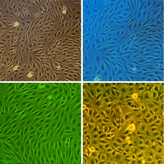 Bovine Brain Microvascular Endothelial Cells: BBMVEC 牛腦微血管內皮細胞：BBMVEC ...