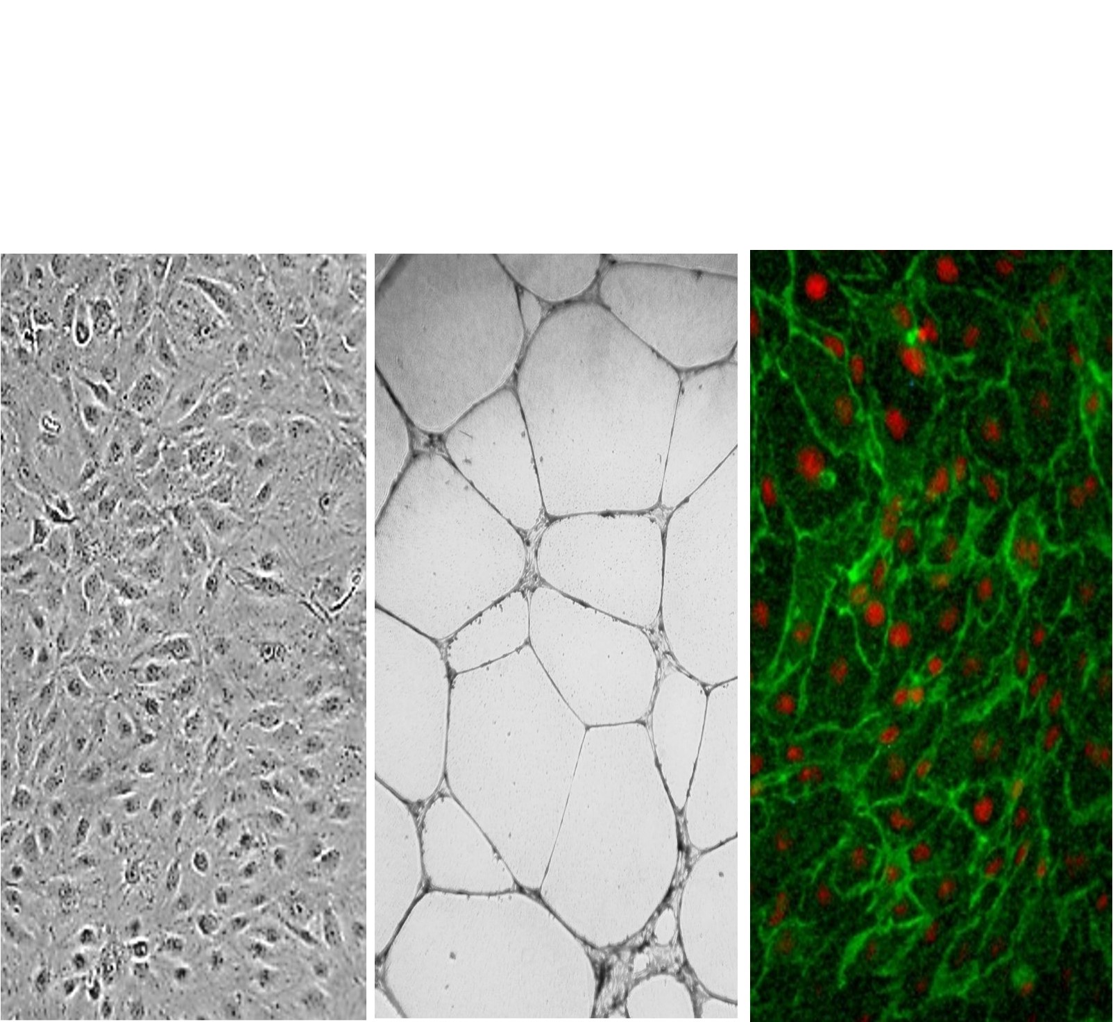 Human Dermal Microvascular Endothelial Cells: CADMEC/HMVEC 人真皮微血管內皮細胞 ...