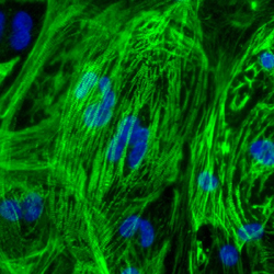 Human Cardiomyocyte Differentiation Media 人心肌細胞分化培養基 | 慧技科學有限公司 Smartec ...