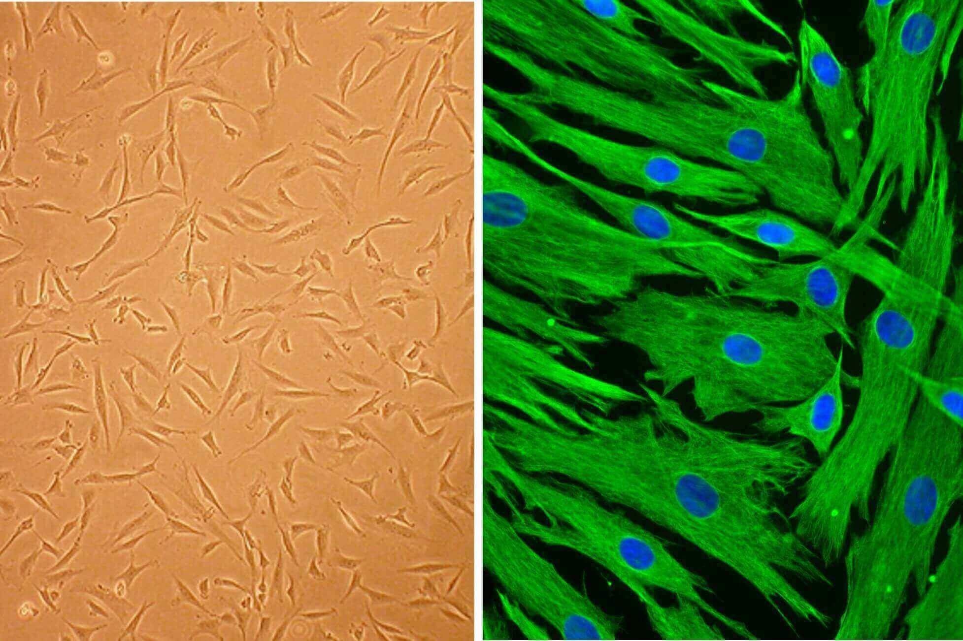 Human Hair Follicle Dermal Papilla Cells: HFDPC 人毛囊真皮乳頭細胞：HFDPC | 慧技科學 ...