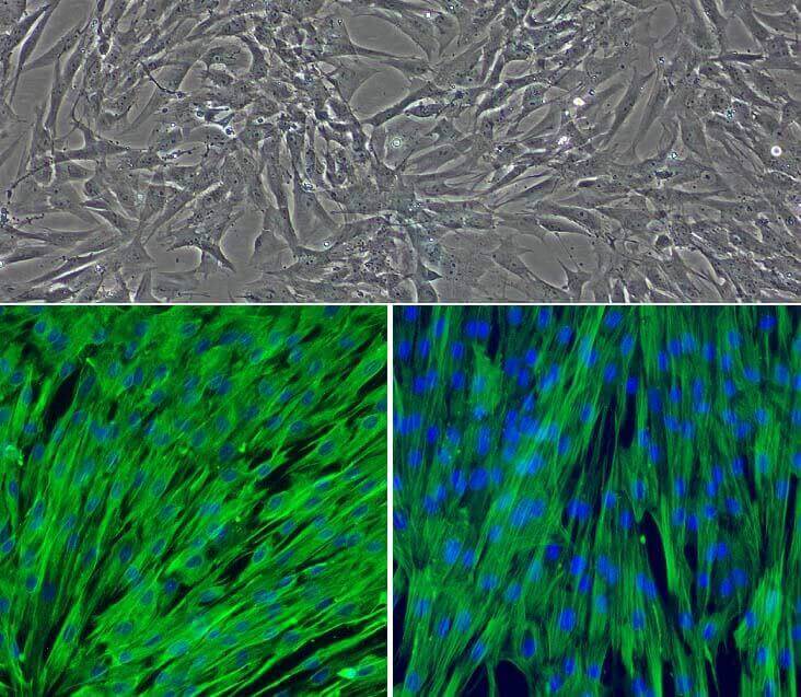 Porcine Cardiac Valve Interstitial Cells: PCVIC 豬心臟瓣膜間質細胞：PCVIC | 慧技科學 ...