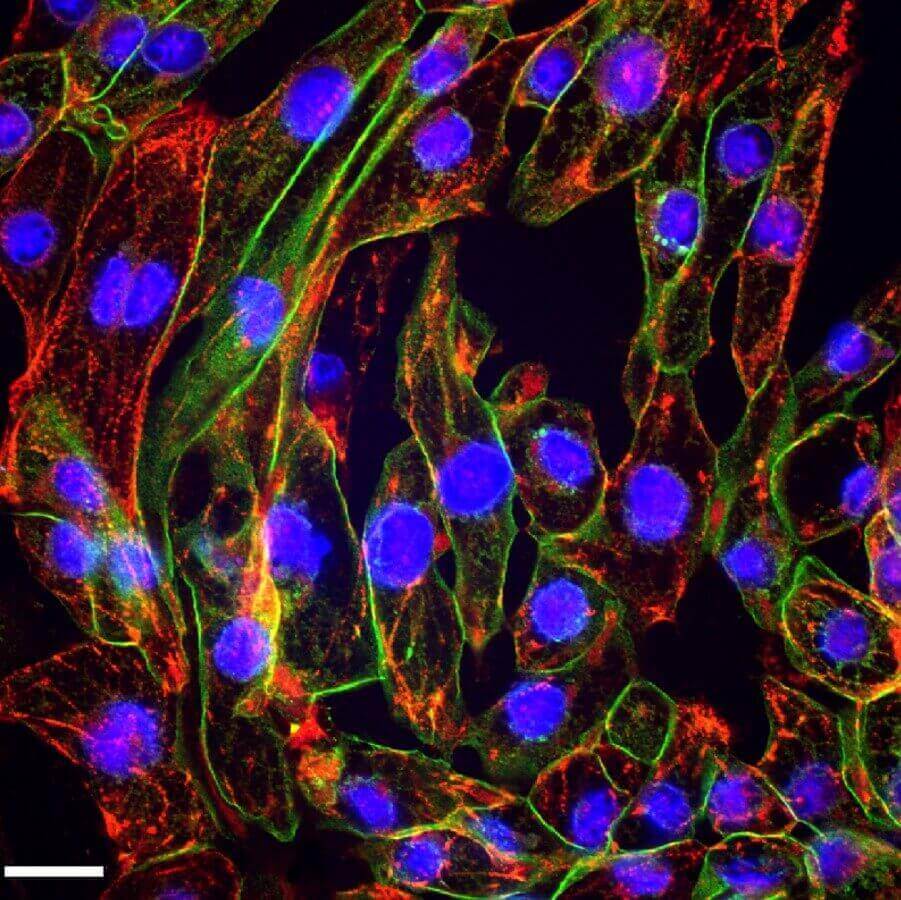 Human iPSC-Derived Cardiac Cells: i-HCm 人 iPSC 衍生的心臟細胞：i-HCm | 慧技科學有限公司 ...